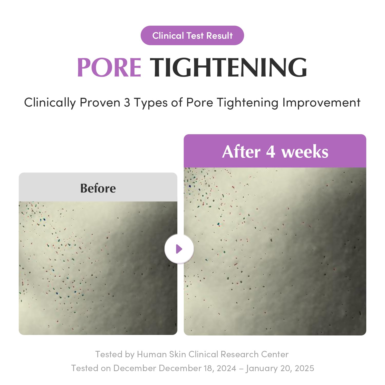 Eqqualberry Purple Rice Pore Smoothing Cleansing Oil - 200ml – Pinoy ...