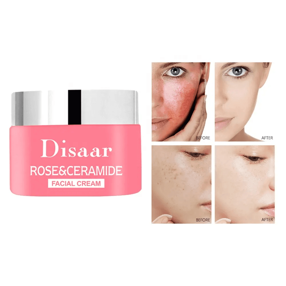 Disaar Rose Ceramide Facial Cream - 50g – Pinoyhyper