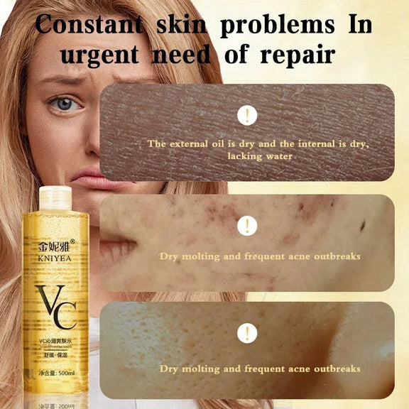 KNIYEA VC Soothing Toner - 500ml – Pinoyhyper