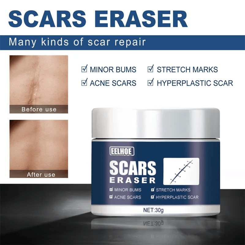 EELHOE Scars Eraser - 30g – Pinoyhyper