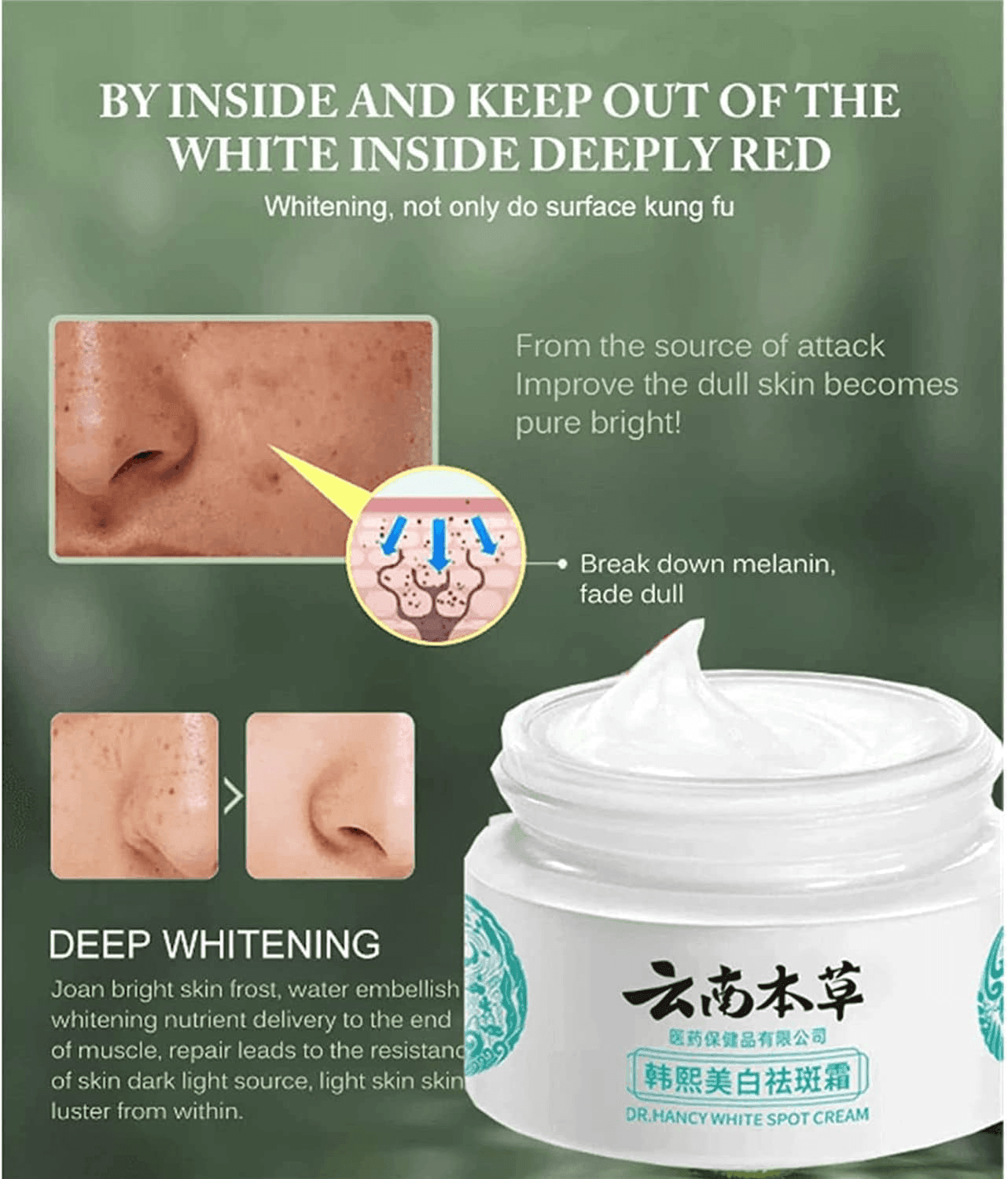 Dr Hancy White Spot Cream Japan Cream - 20g – Pinoyhyper