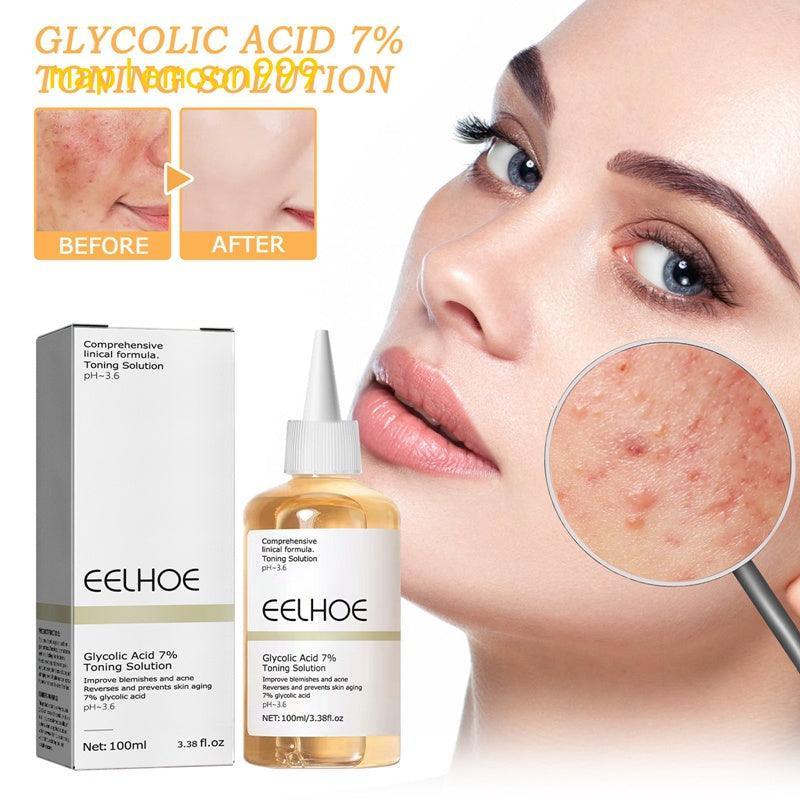 Eelhoe Glycolic Acid 7% Toning Solution - 100ml – Pinoyhyper