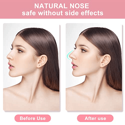 Rhino Plasty Nose Up Lifting Shaping Set Clipper – Pinoyhyper