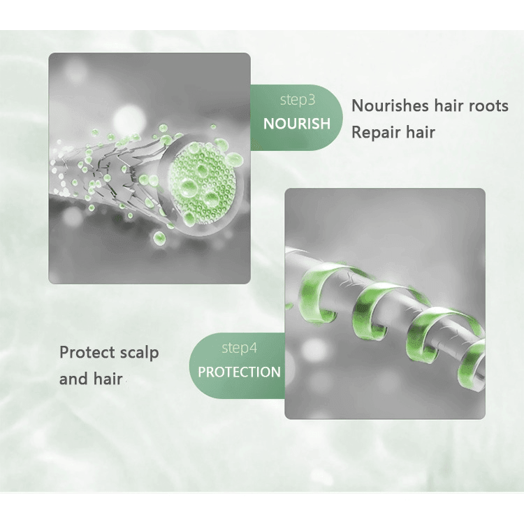 Tree City Aloe Vera Anti Dandruff Shampoo - 500ml – Pinoyhyper