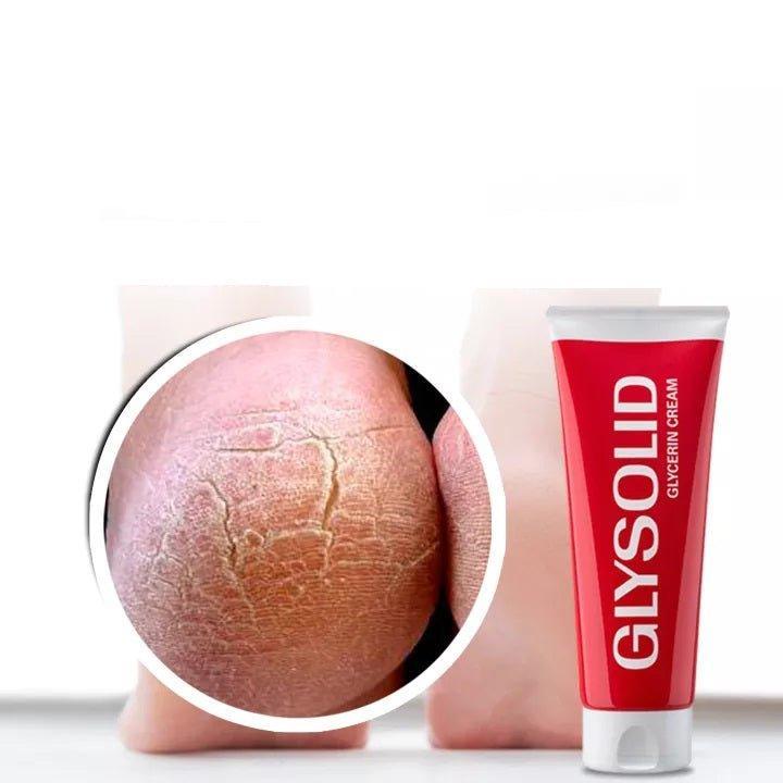 Glysolid Glycerin Cream Tube - 100ml – Pinoyhyper