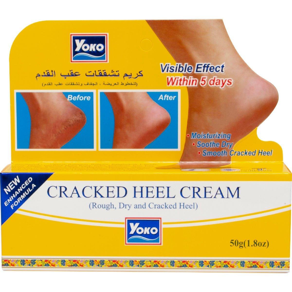Yoko Cracked Heel Cream 50g – Pinoyhyper